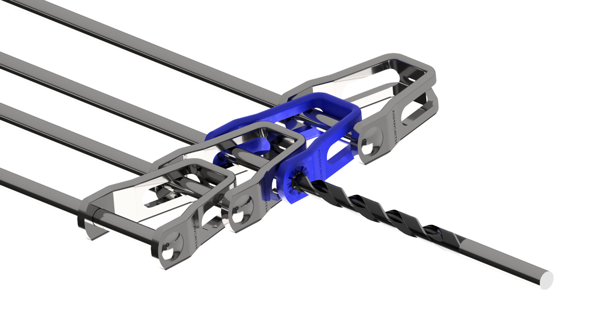 Rapid Splice® by Ashworth Splices Like Plastic. Performs Like Metal.